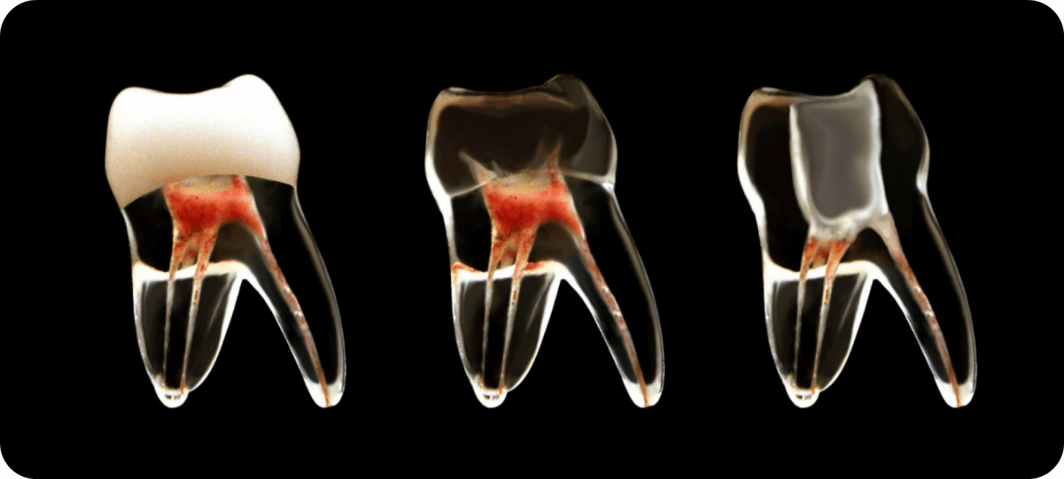 Dental Training Models | DRSK
