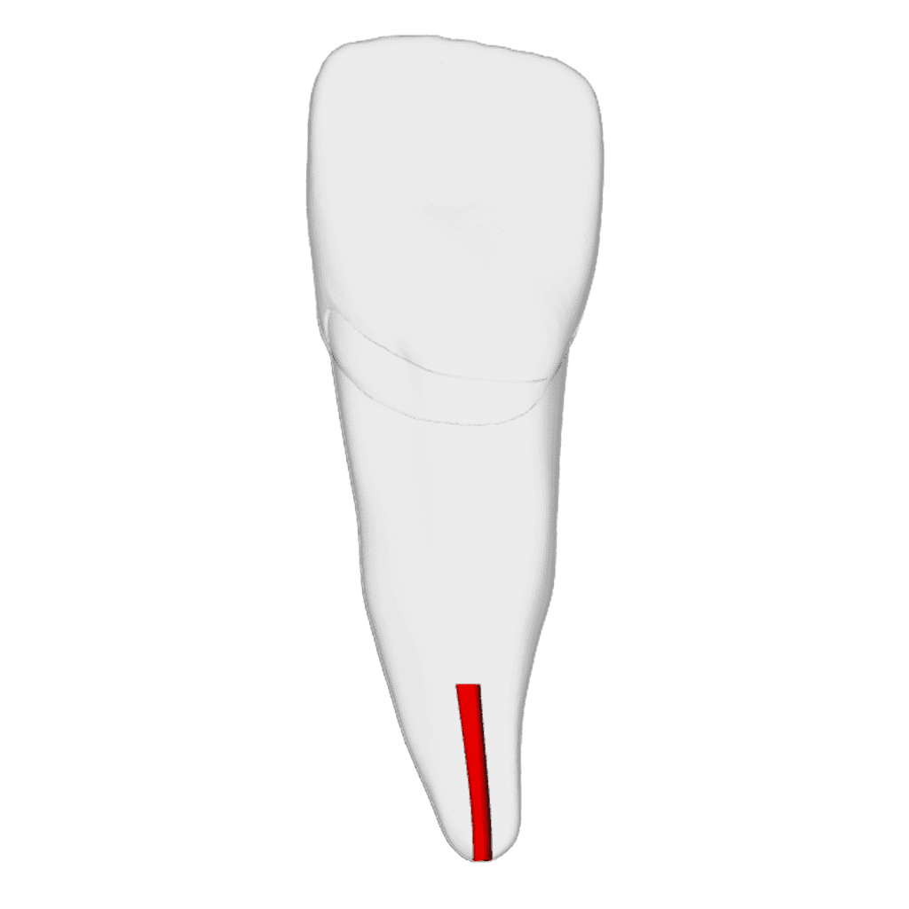 Endodontic Model | Dental Training Models | DRSK