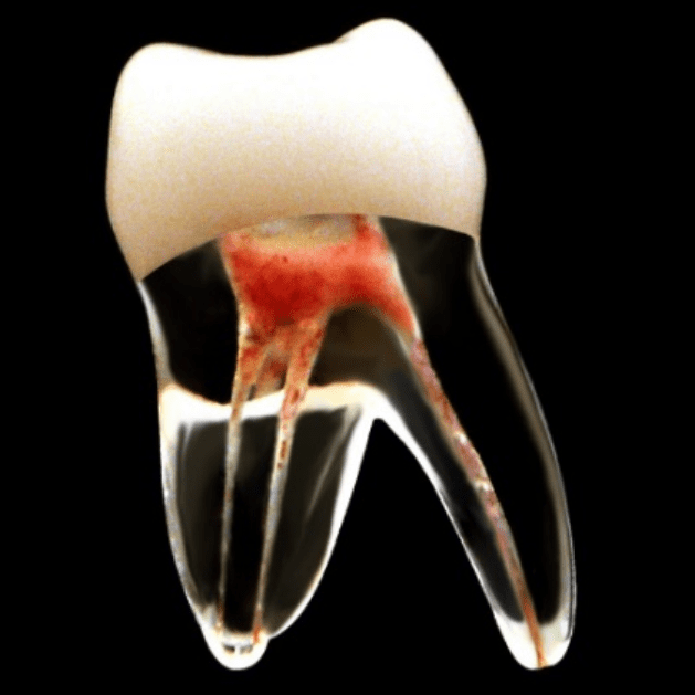Endodontic Tooth Models | Dental Training Models | DRSK