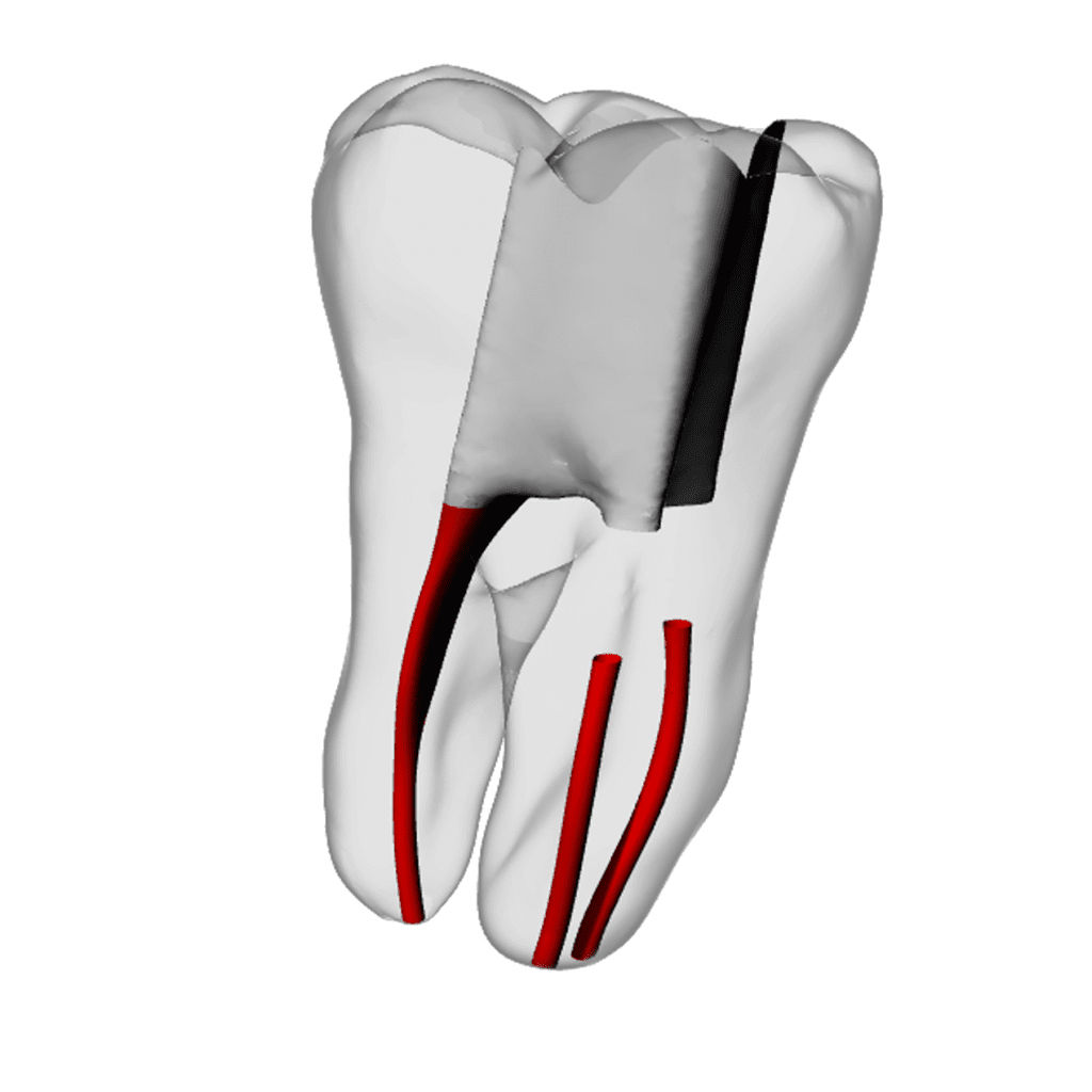 Endodontic Model | Dental Training Models | DRSK