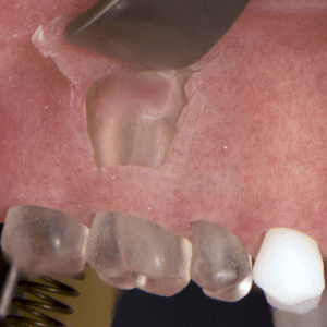 Modular Jaw Model | Dental Training Models | DRSK