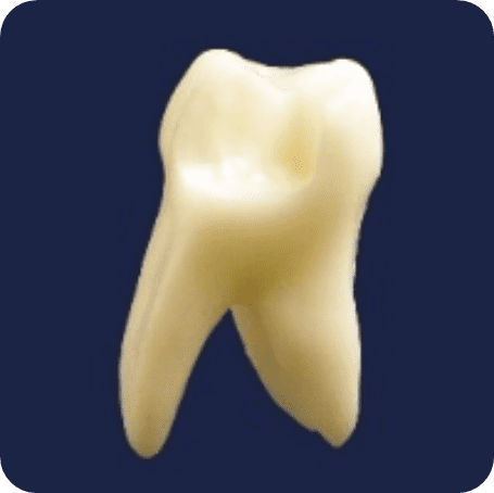 Maxillary Molar - Class II Cavity | Dental Training Models | DRSK