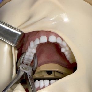 Tooth Extraction Model | Dental Training Models | DRSK