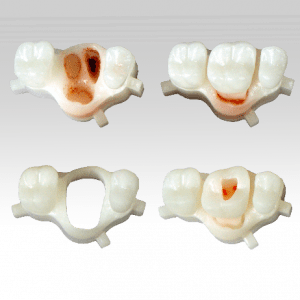 Modular Jaw Model | Dental Training Models | DRSK