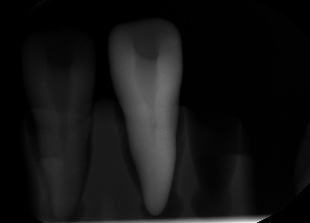 Endodontic Model | Dental Training Models | DRSK
